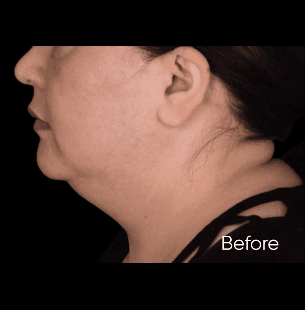 Why The Neck Is The New Face + What To Do About “Tech Neck” - VITA Daily